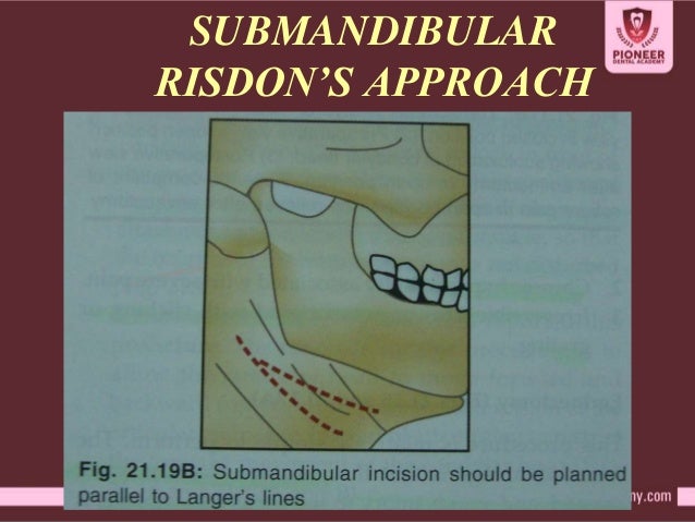 TMJ PPT By Dr.Nasser