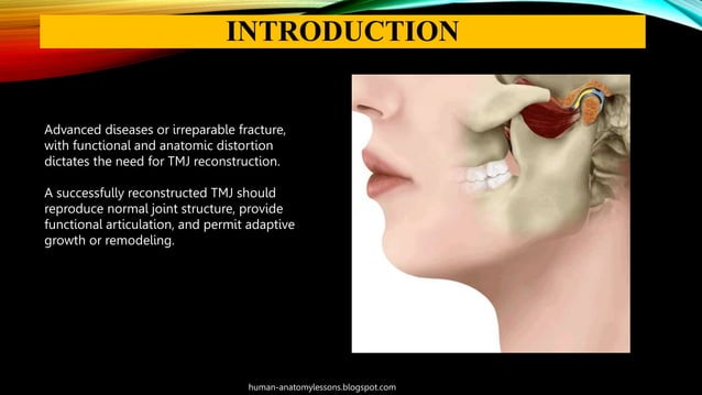 TMJ RECONSTRUCTION | PPTX