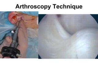 TMJ Anatomy | PPT