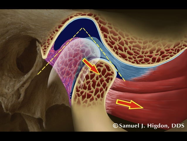 Tmj anatomy | PPT