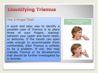 Tmj anatomy and problems by Dr.mostafa kareem | PPTX