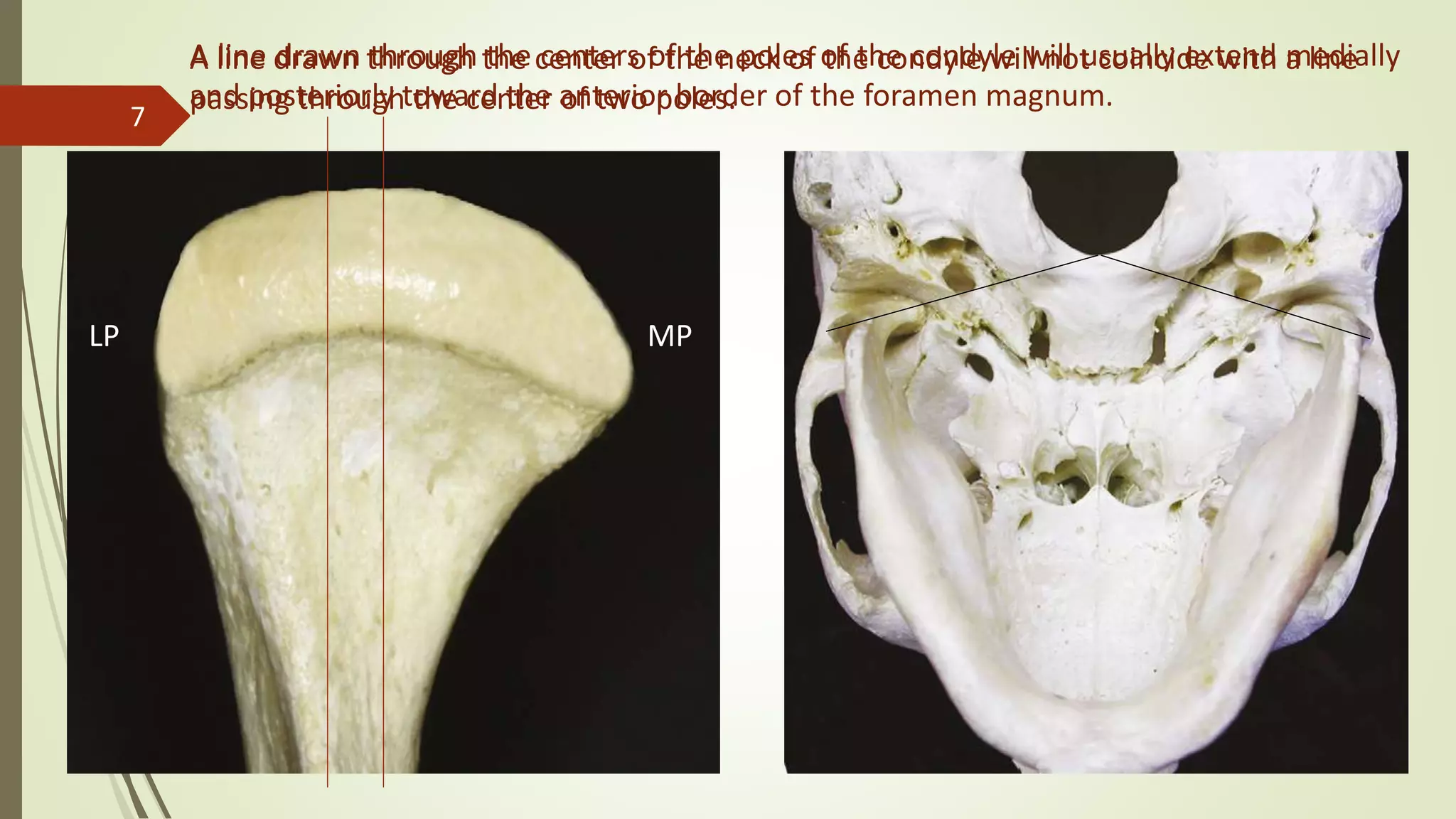 TMJ Anatomy and TMD | PPTX