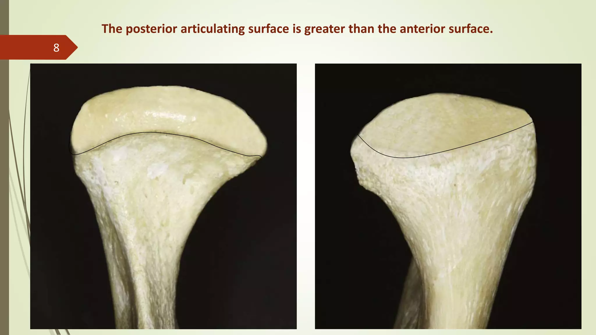 Tmj Anatomy And Tmd Ppt