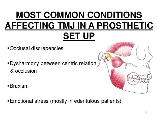 Tmj and prosthodontic implications