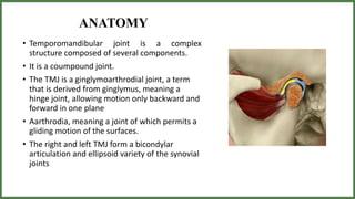 Tmj ankylosis | PPTX