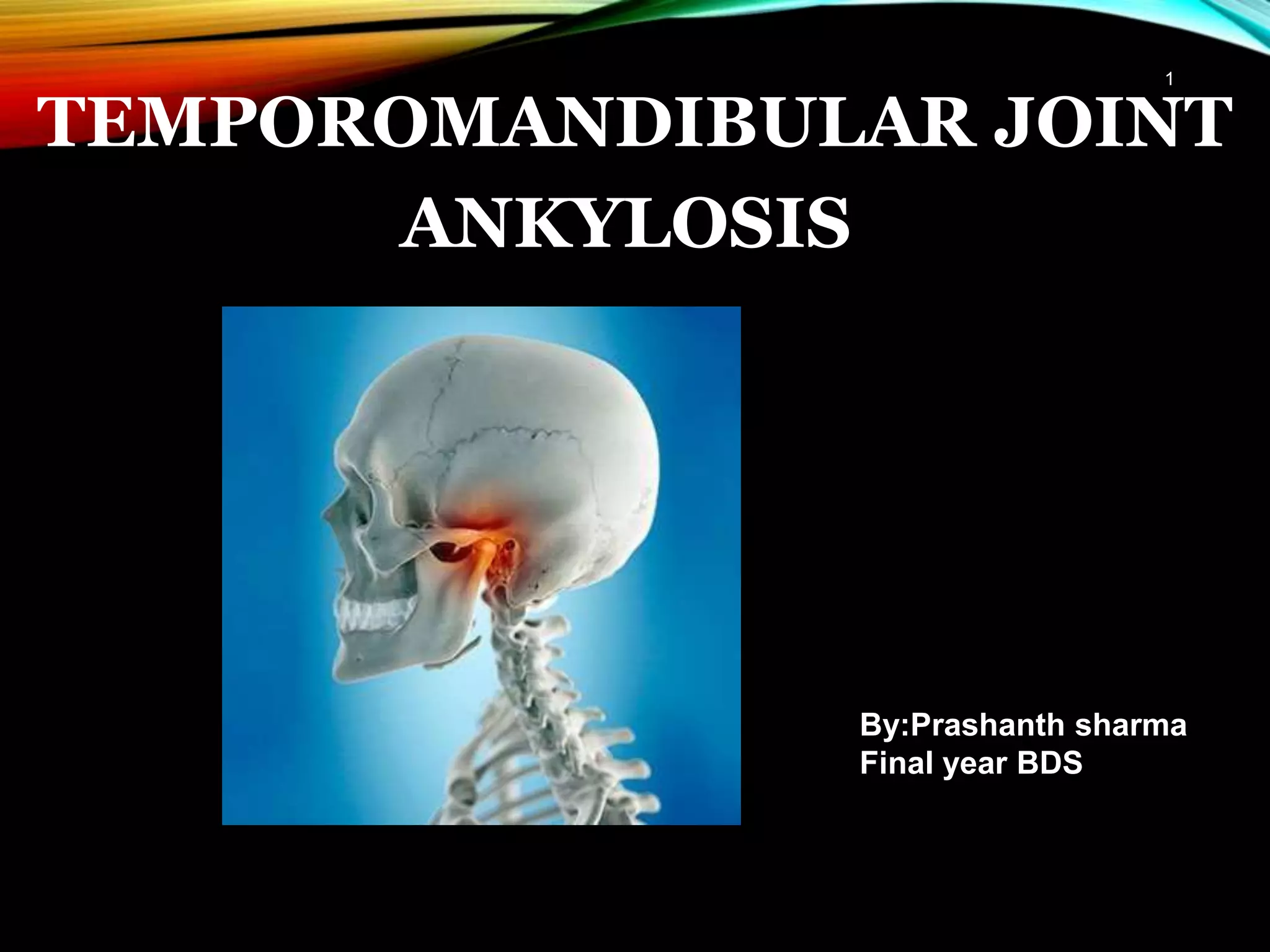Tmj ankylosis-oral and maxillofacial surgery | PPTX