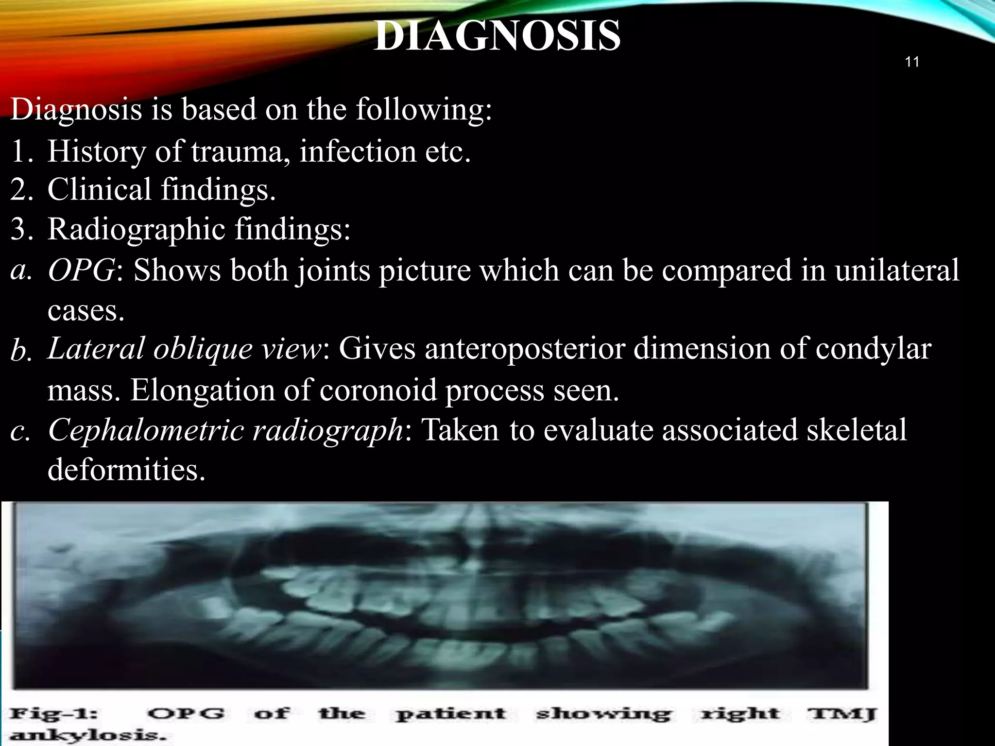 Tmj ankylosis-oral and maxillofacial surgery | PPTX