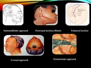 Tmj ankylosis-oral and maxillofacial surgery | PPTX