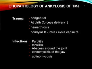 Tmj ankylosis-oral and maxillofacial surgery | PPTX