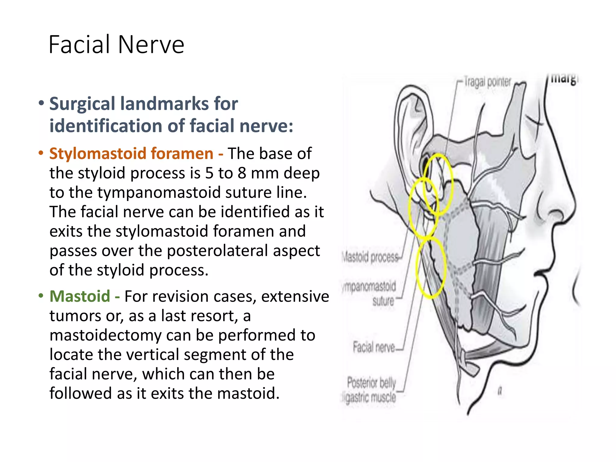 Temporomandibular joint ankylosis and its management | PPTX