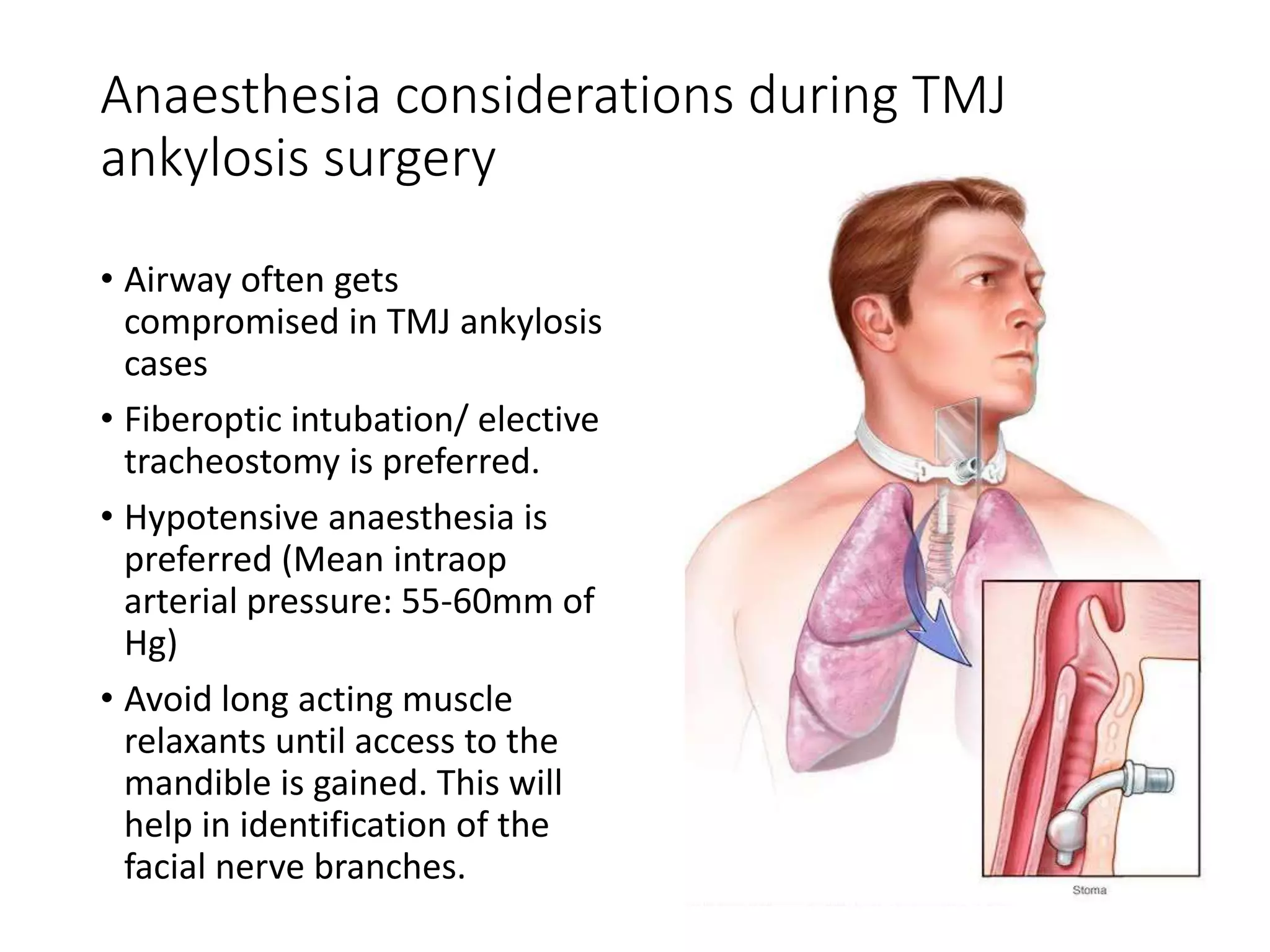 Temporomandibular joint ankylosis and its management | PPTX