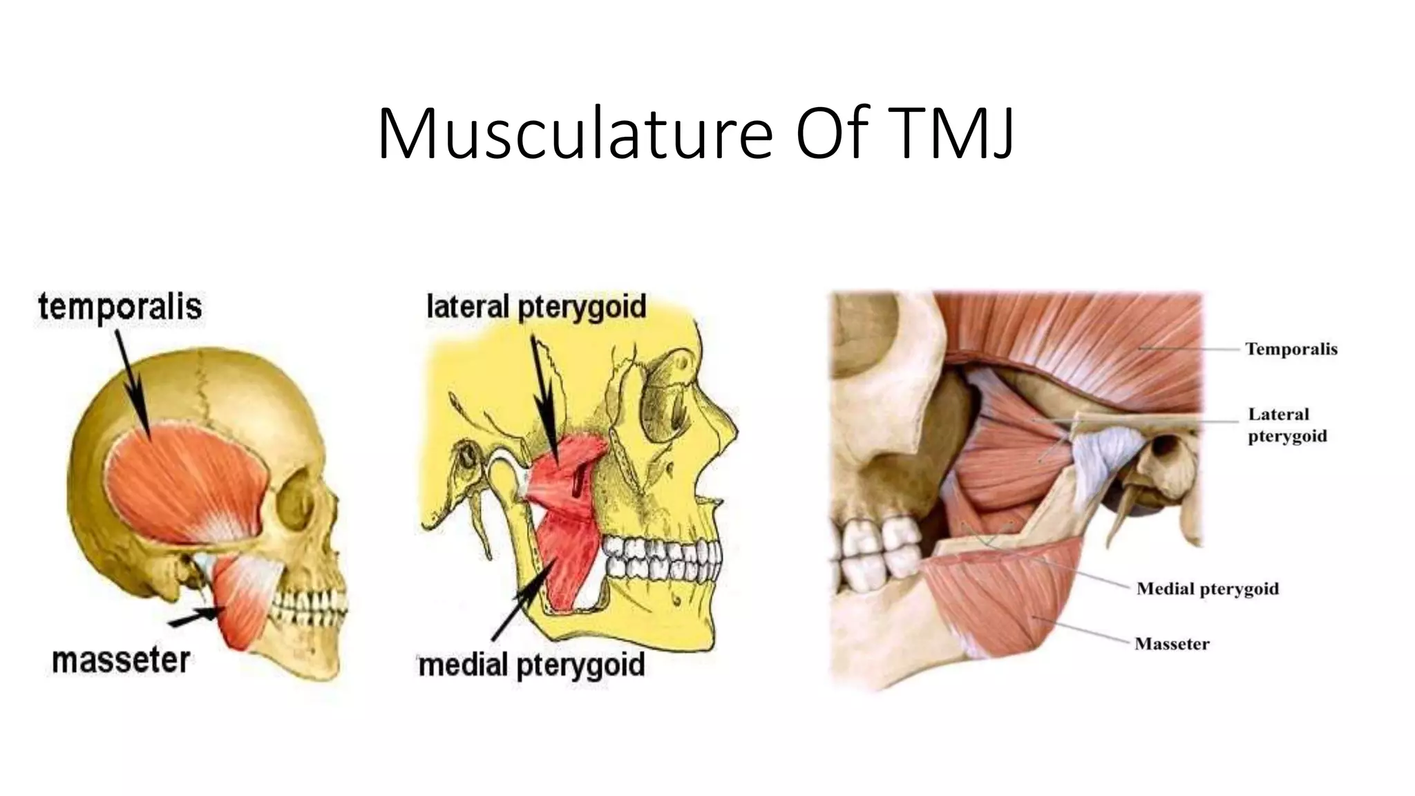 TMJ Ankylosis & It's Management | PPTX