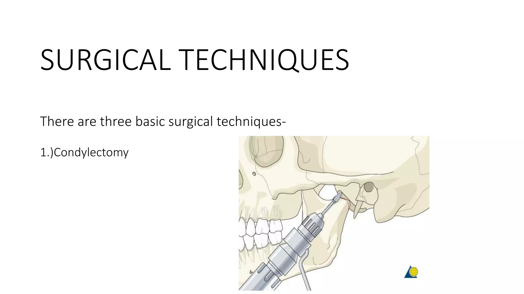 TMJ Ankylosis & It's Management | PPTX