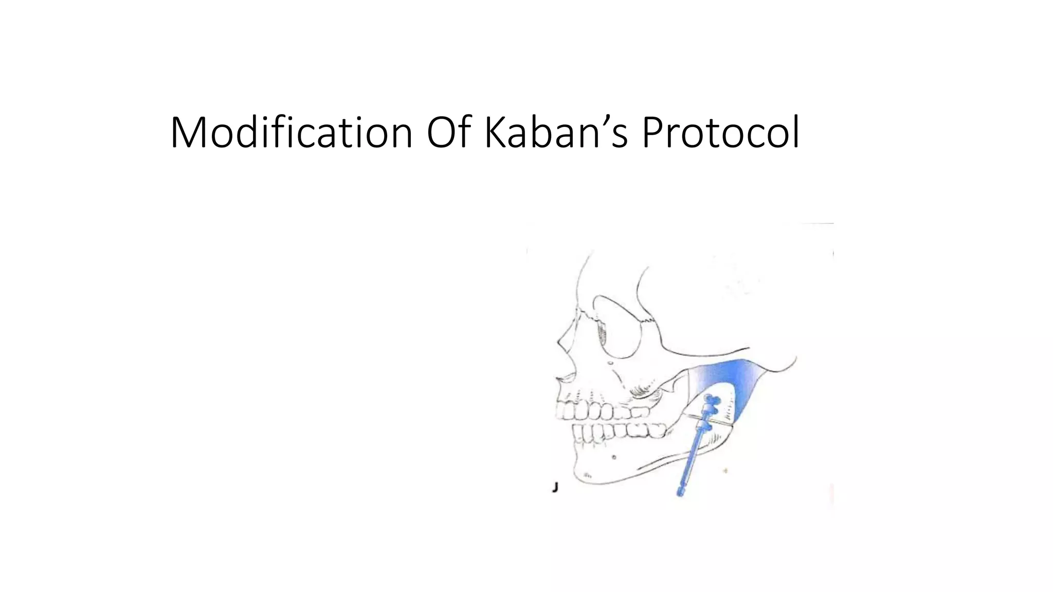 TMJ Ankylosis & It's Management | PPTX