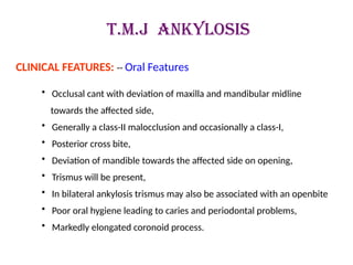 TMJ Ankylosis for oral and maxillofacial surgery | PPTX