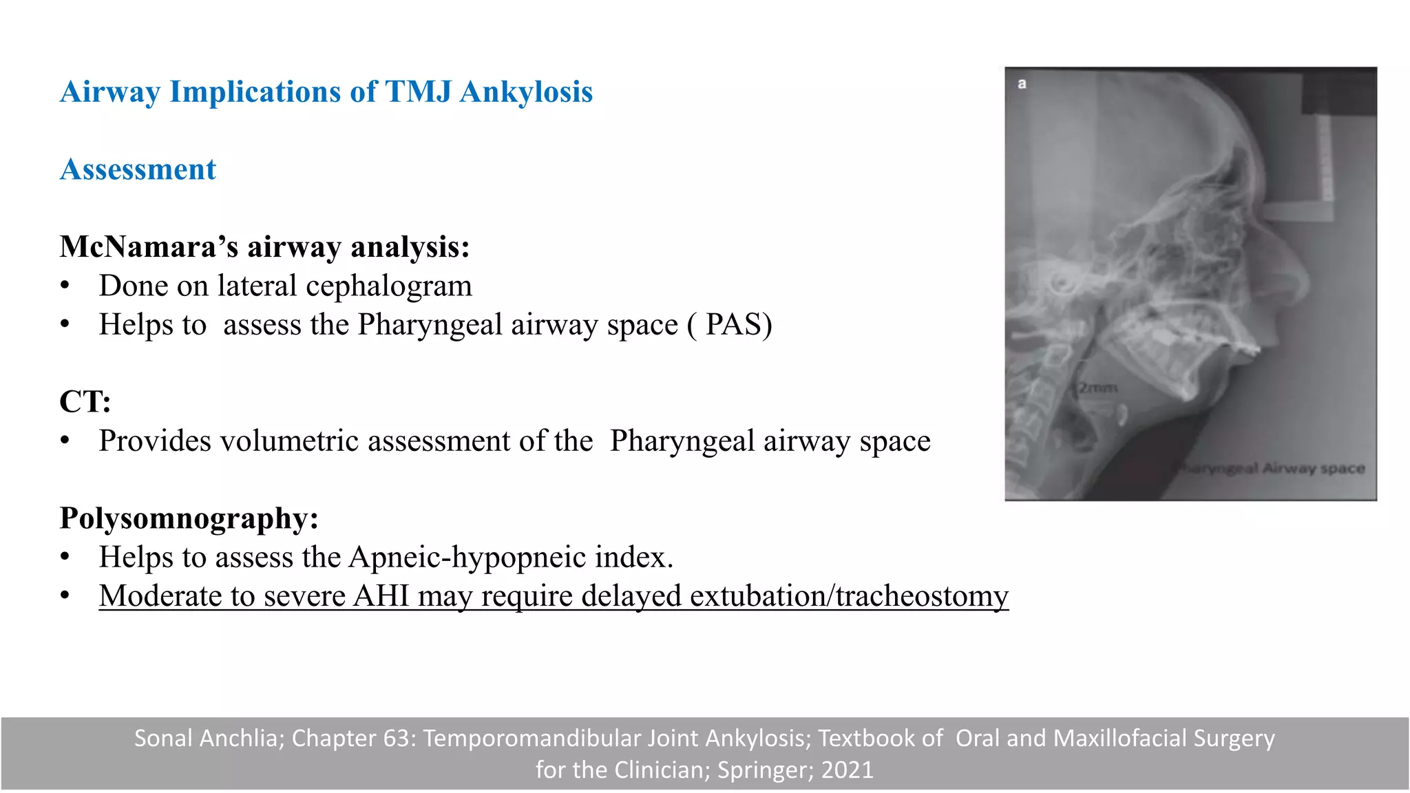 TMJ ankylosis and reconstruction.pptx
