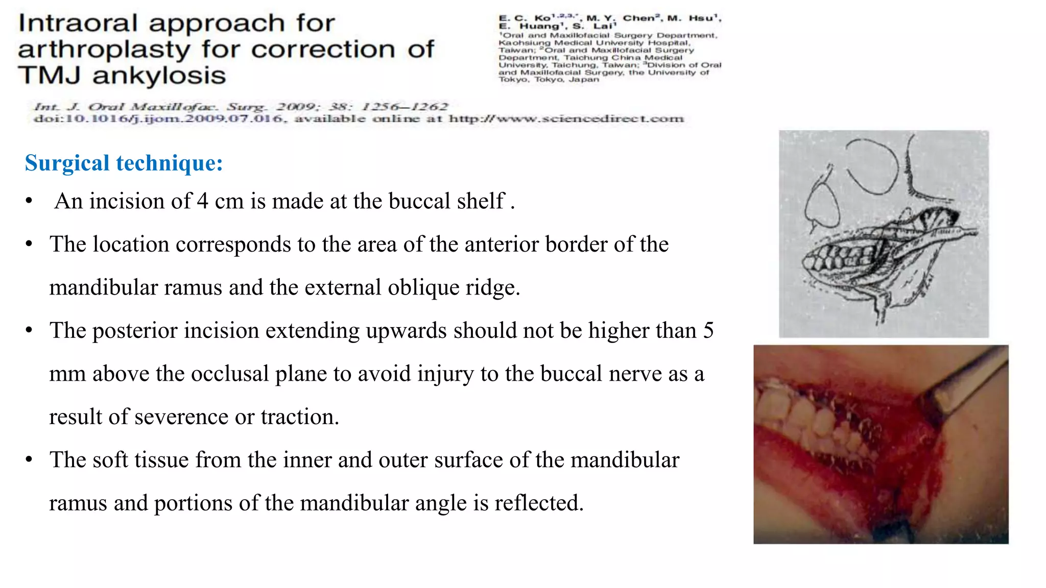 TMJ ankylosis and reconstruction.pptx