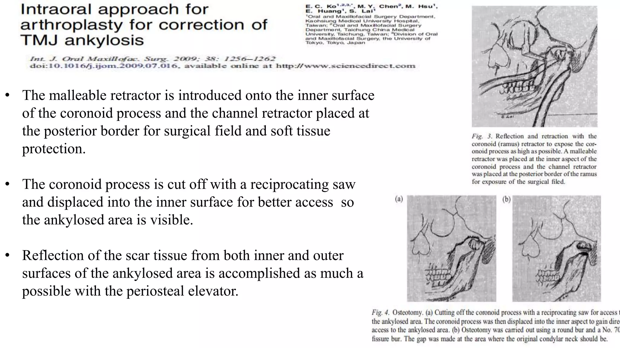 TMJ ankylosis and reconstruction.pptx
