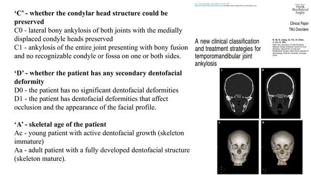 TMJ ankylosis and reconstruction.pptx