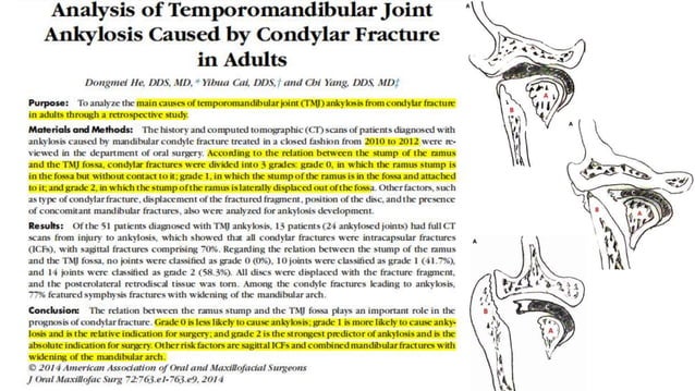 TMJ ankylosis and reconstruction.pptx
