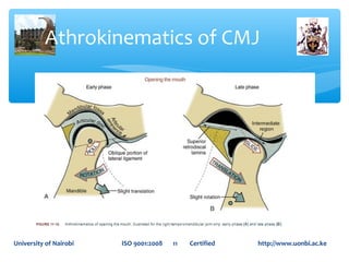 Tmj ankylosis overview | PPT