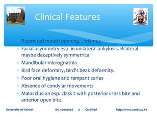 Tmj ankylosis overview | PPT