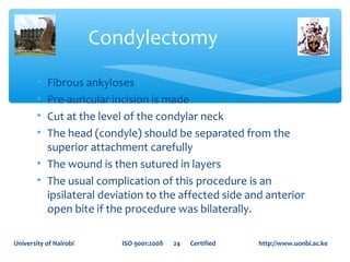 Tmj ankylosis overview | PPT