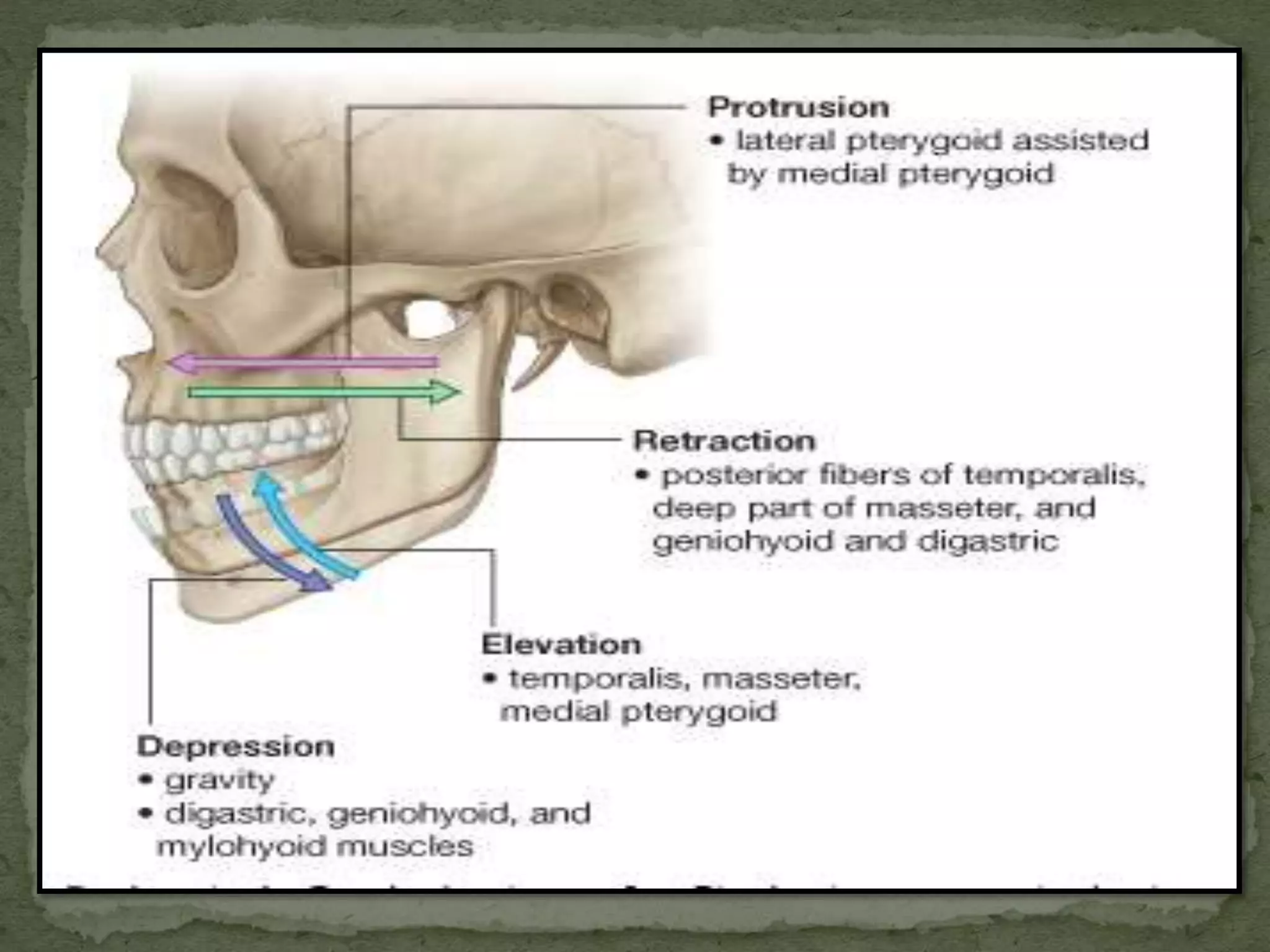 Tmj & ankylosis ppt | PPTX