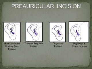 Tmj & ankylosis ppt | PPTX