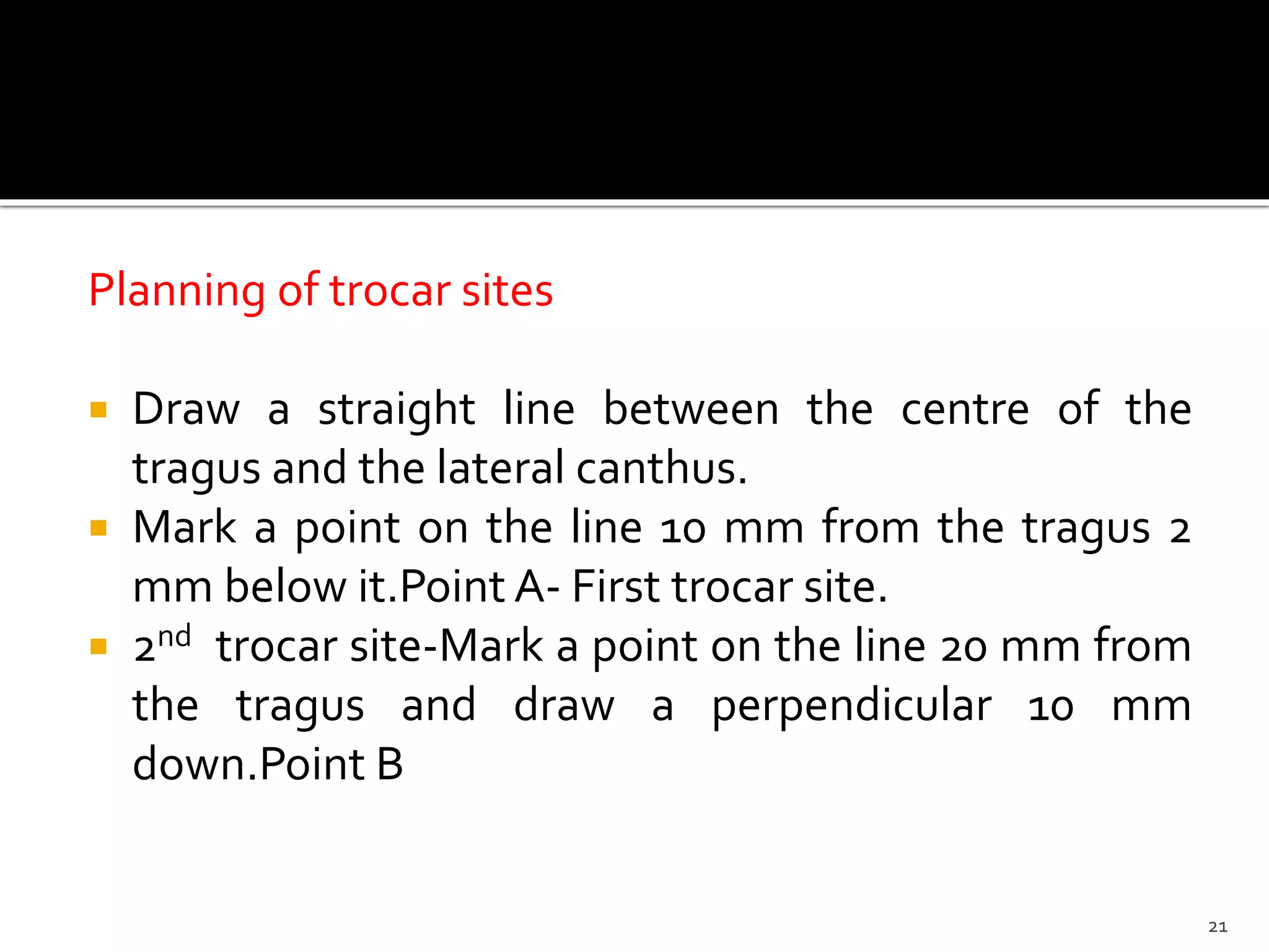 Tmj arthroscopy | PPTX