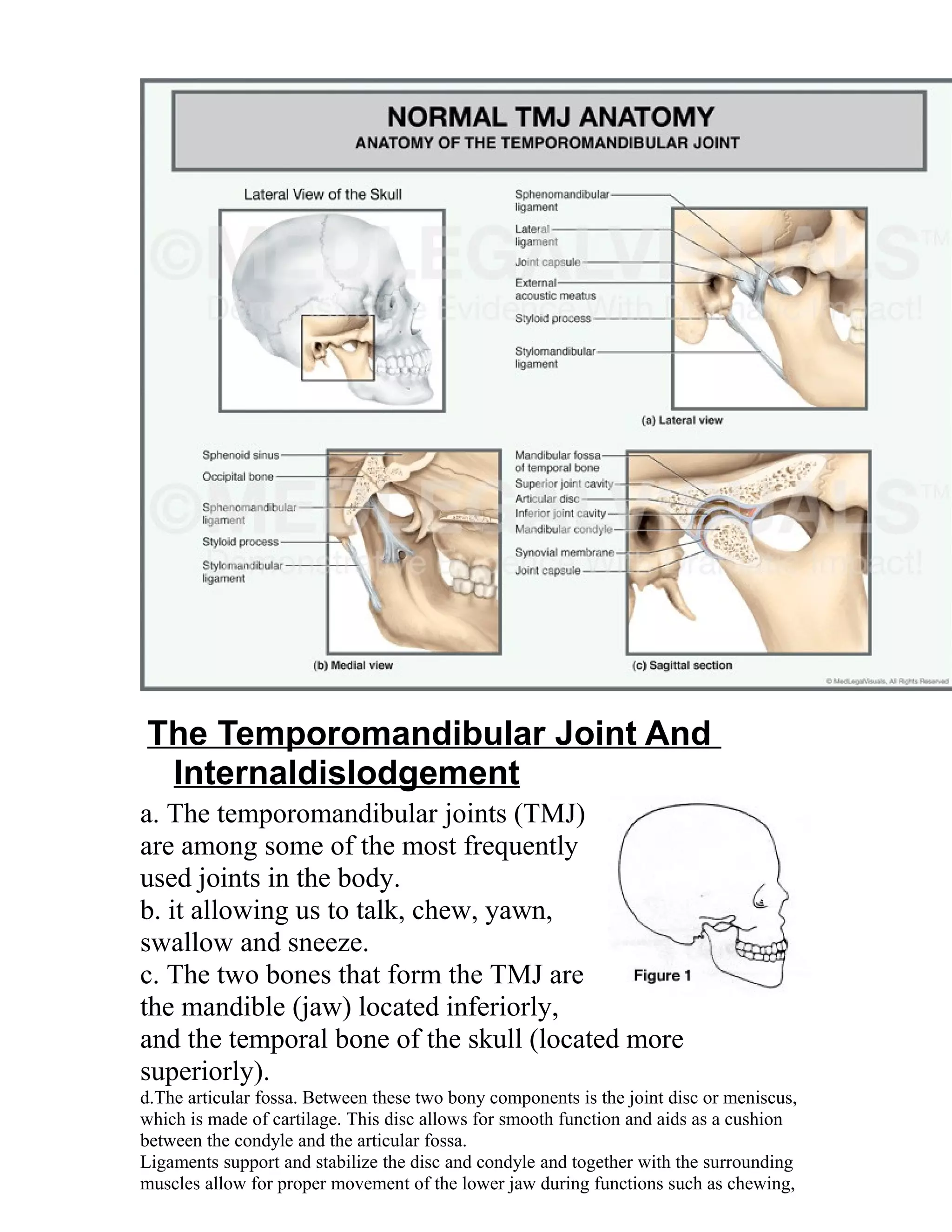 Tmj dislocation | DOC