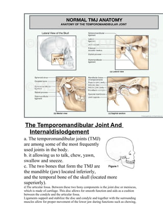 Tmj dislocation | DOC