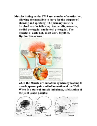Tmj dislocation | DOC