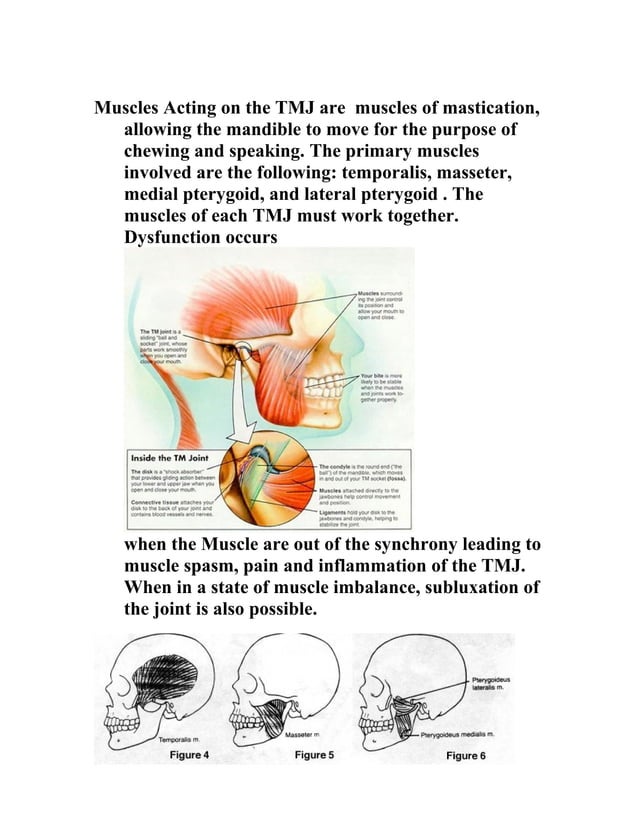 Tmj dislocation | PDF