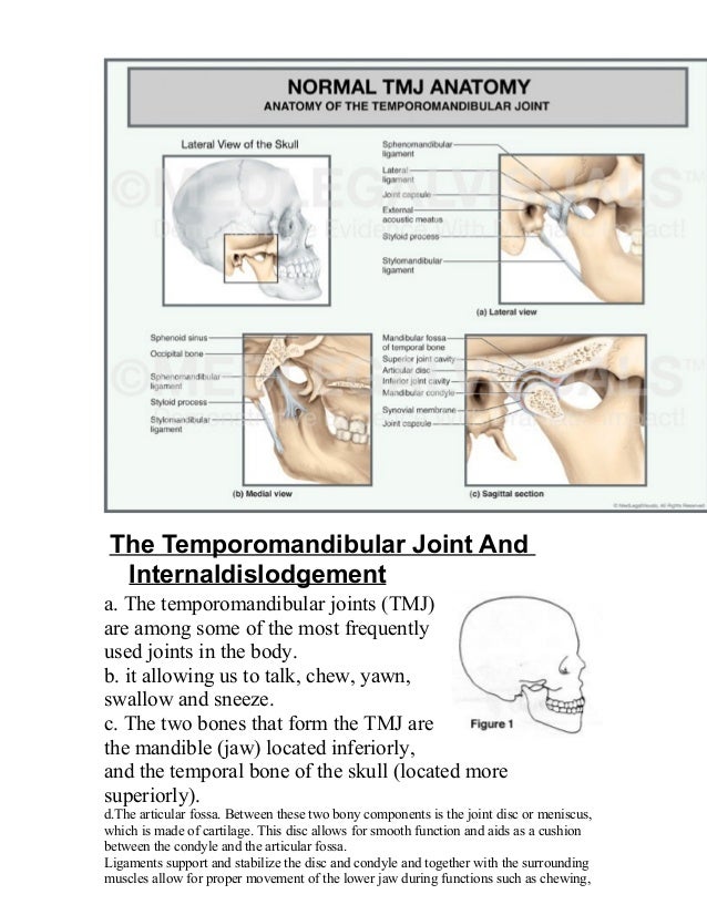 Tmj dislocation