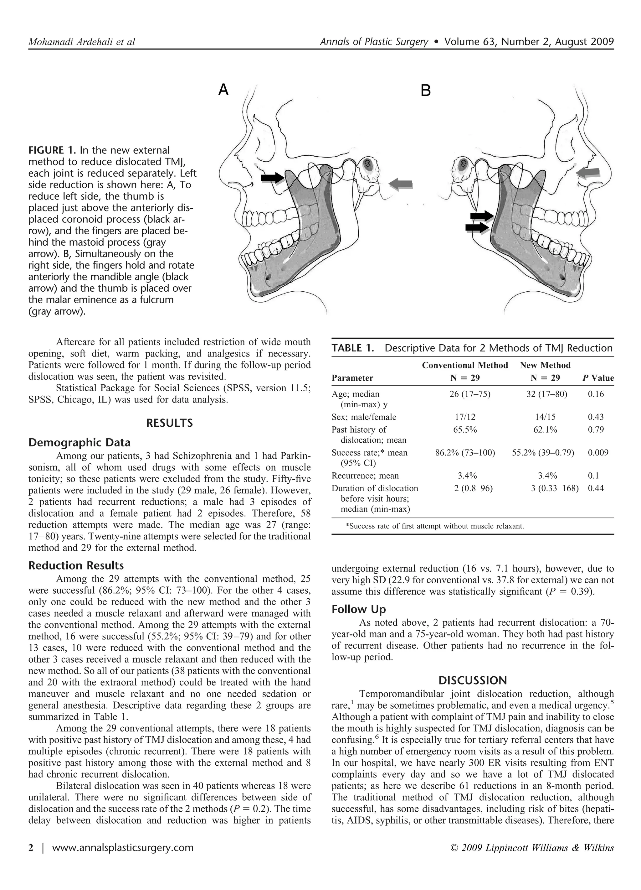 Tmj dislocation | PDF