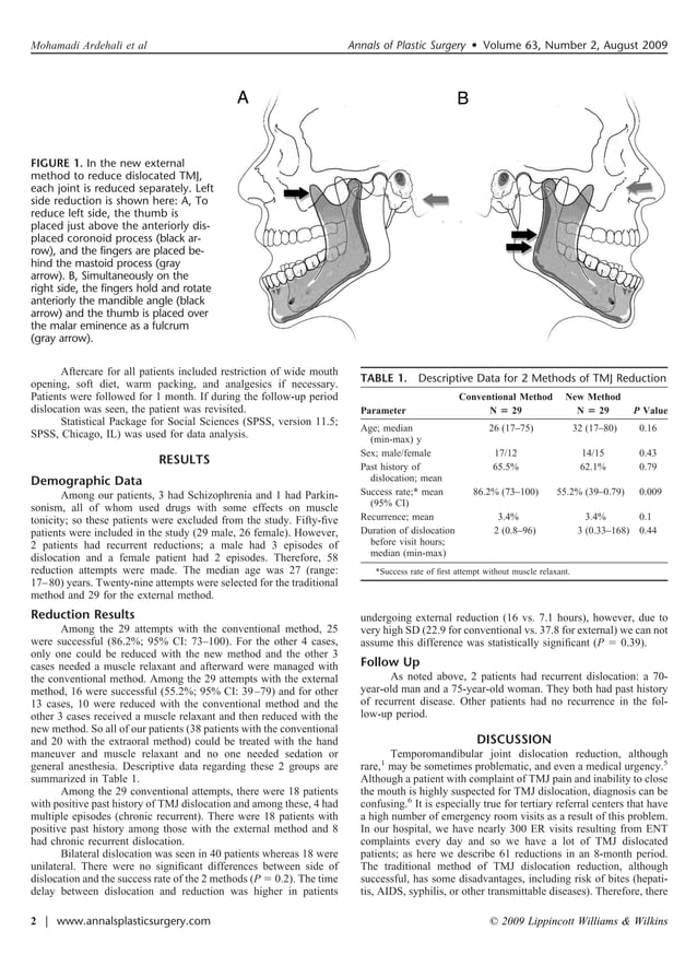 Tmj dislocation | PDF