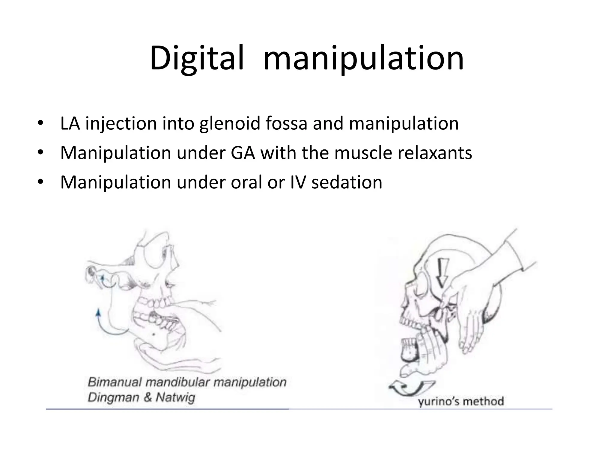 Clinical features,presentation,clinical and surgical management of TMJ ...