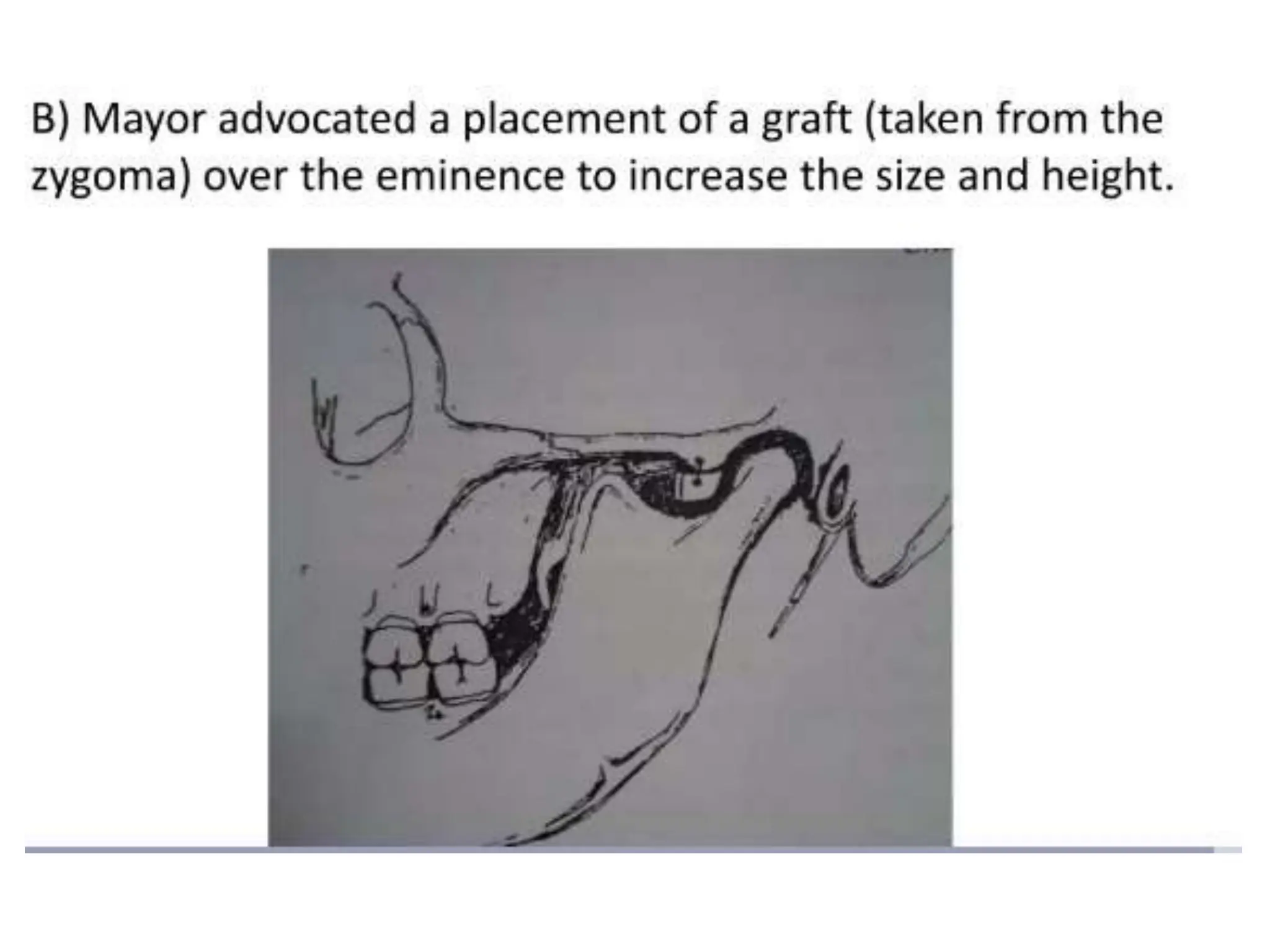 Clinical features,presentation,clinical and surgical management of TMJ ...