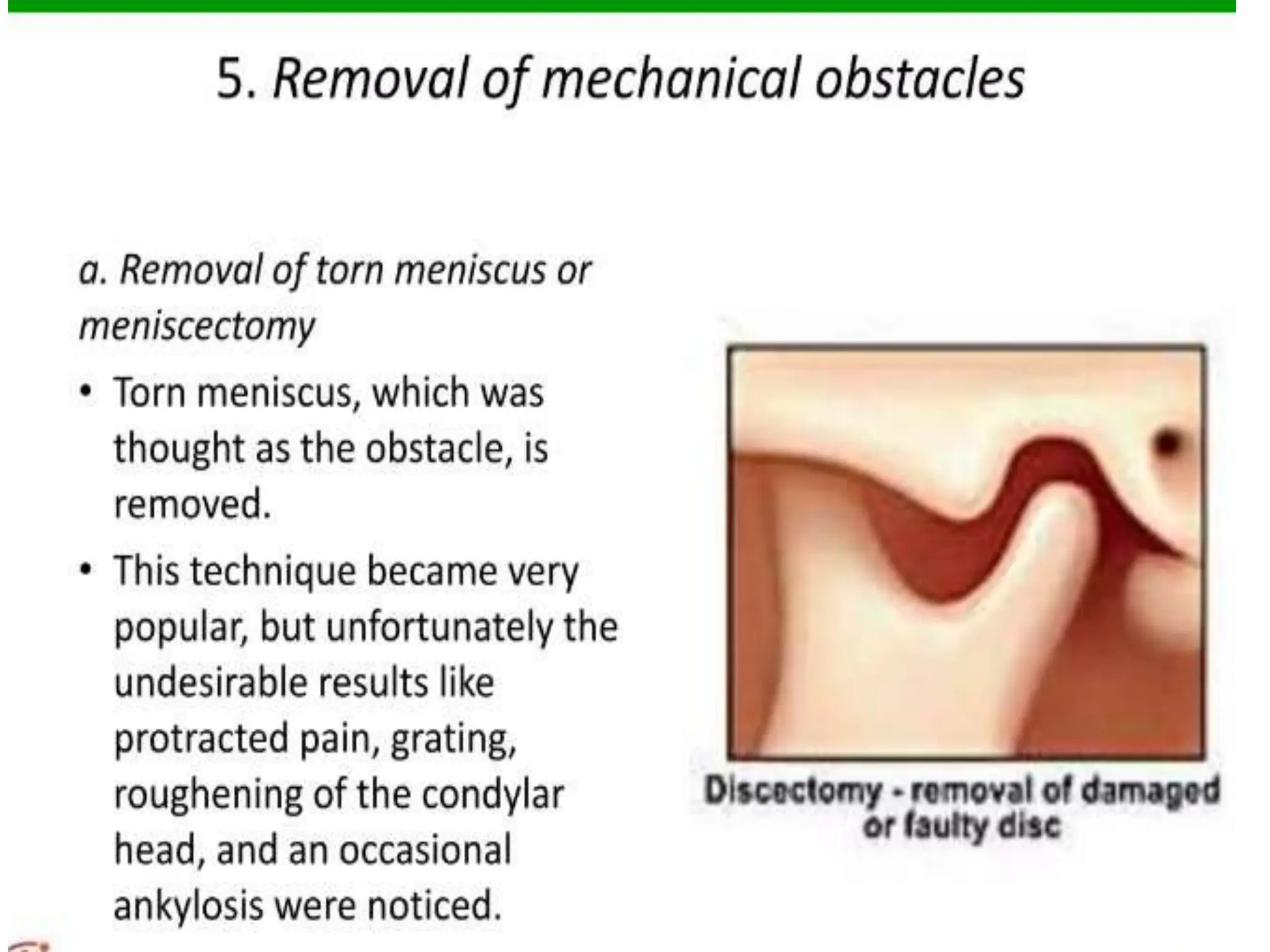 Clinical Features Presentation Clinical And Surgical Management Of Tmj