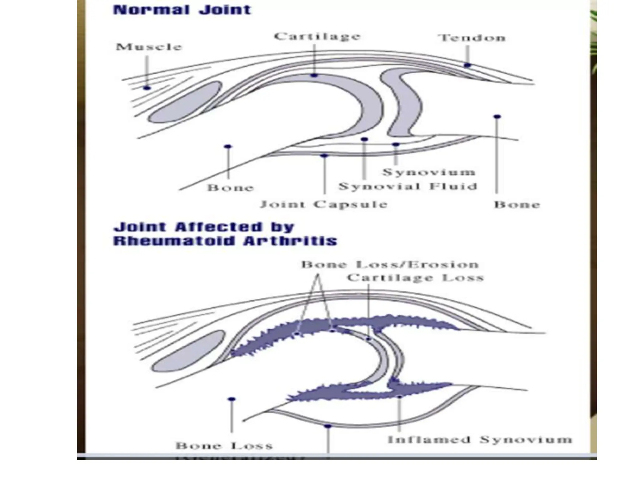 Clinical features,presentation,clinical and surgical management of TMJ ...