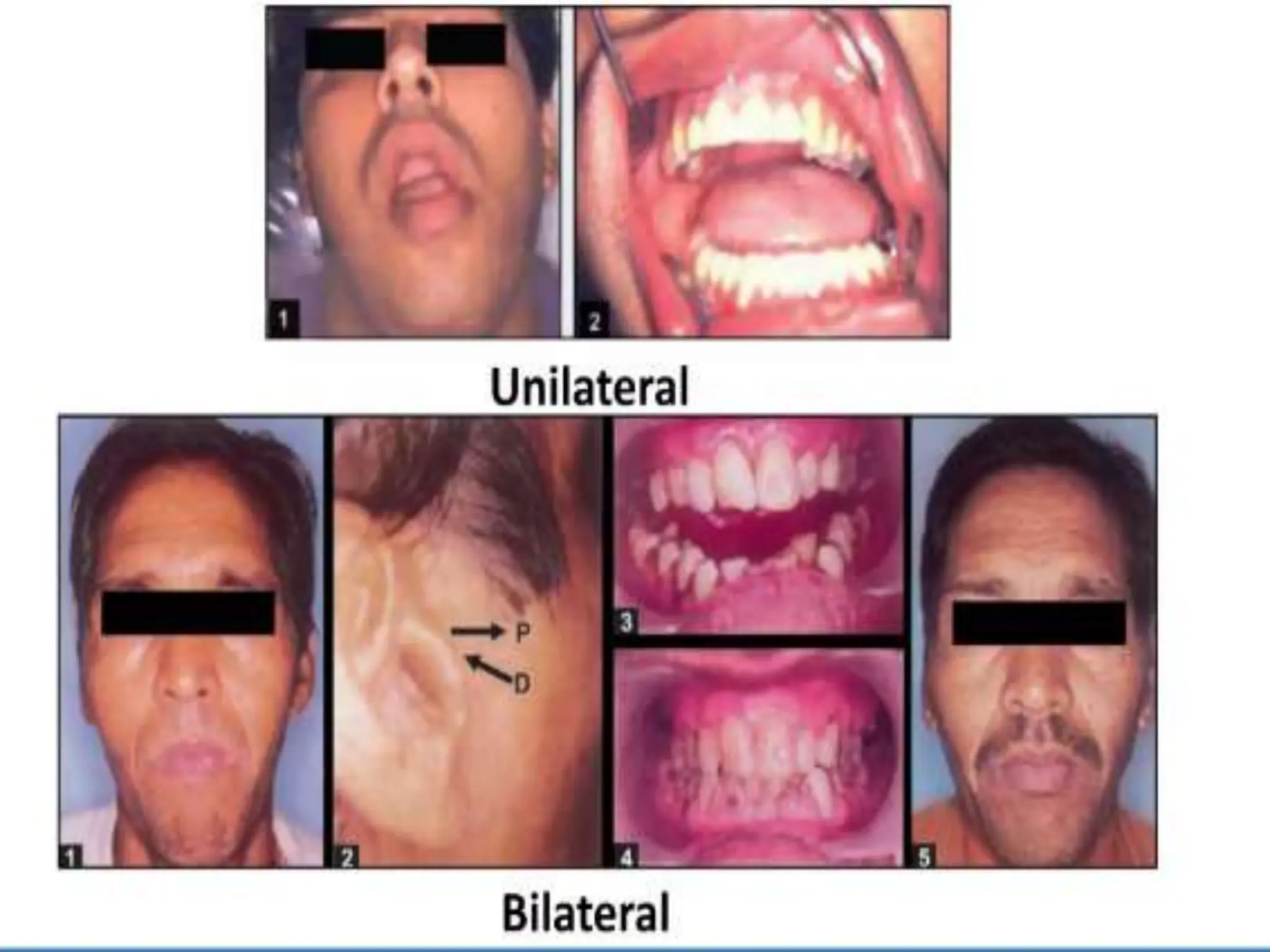 Clinical features,presentation,clinical and surgical management of TMJ ...