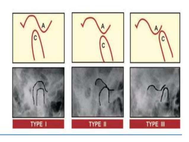 Clinical features,presentation,clinical and surgical management of TMJ ...