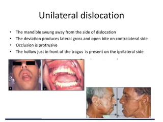 Clinical features,presentation,clinical and surgical management of TMJ ...
