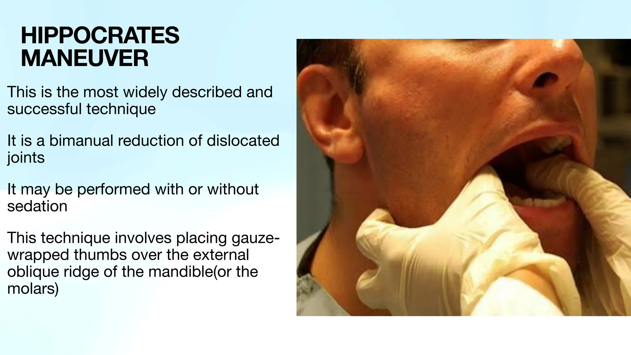 MANAGEMENT OF TEMPEROMANDIBULAR JOINT DISLOCATION | PPT