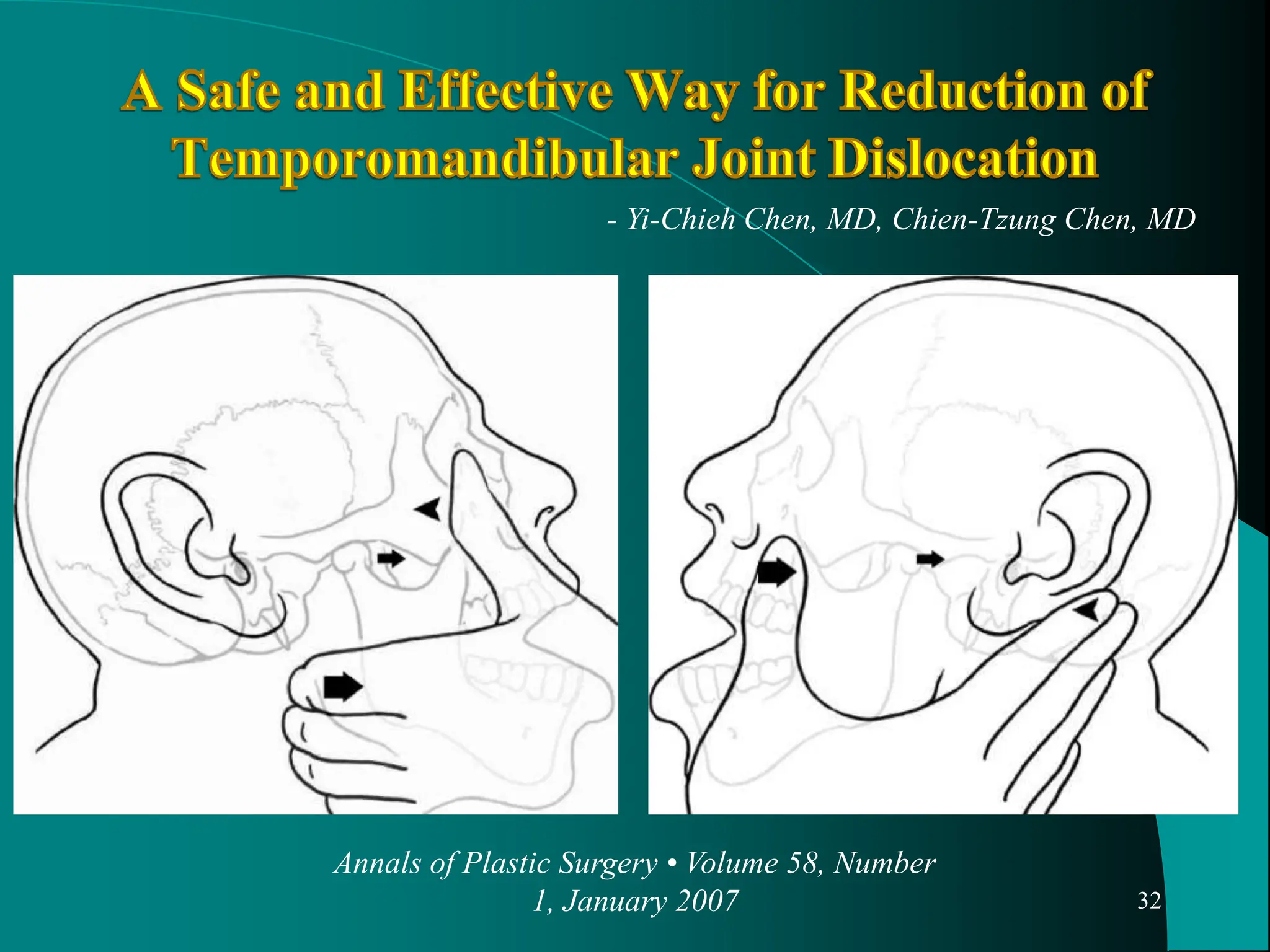 TMJ DISLOCATION AND ITS MANAGEMENT..pptx