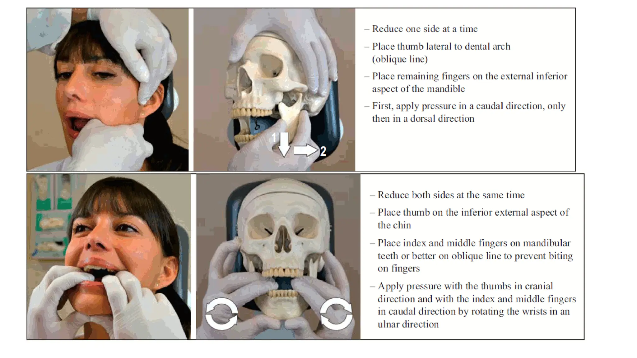 TMJ Dislocation for Anaestheologists final.pptx
