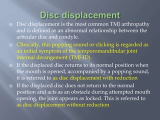 Tmj disorder | PPTX
