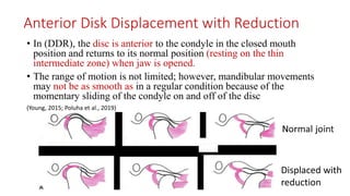 TMJ disorder and managment.pptx