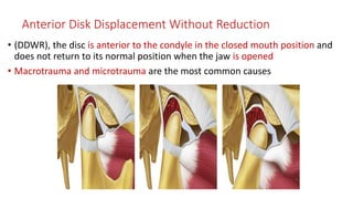 TMJ disorder and managment.pptx
